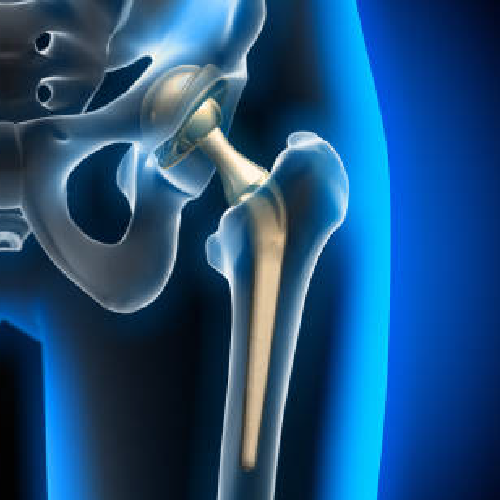 Super Speciality Hospital in Greater Kailash - SCI International Hospital